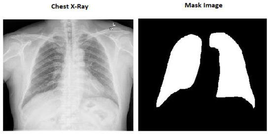 Deep Neural Network for Lung Image Segmentation on Chest X-ray