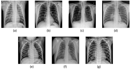 Multi-Scale CNN: An Explainable AI-Integrated Unique Deep Learning ...