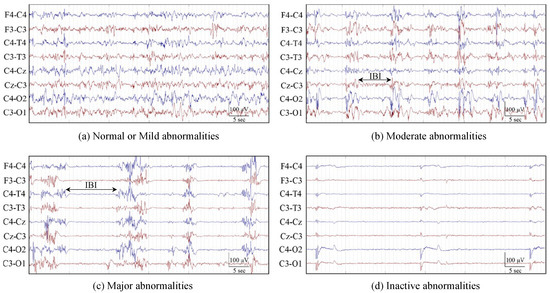 Technologies | Free Full-Text | Neonatal Hypoxic-Ischemic Encephalopathy Grading from Multi ...
