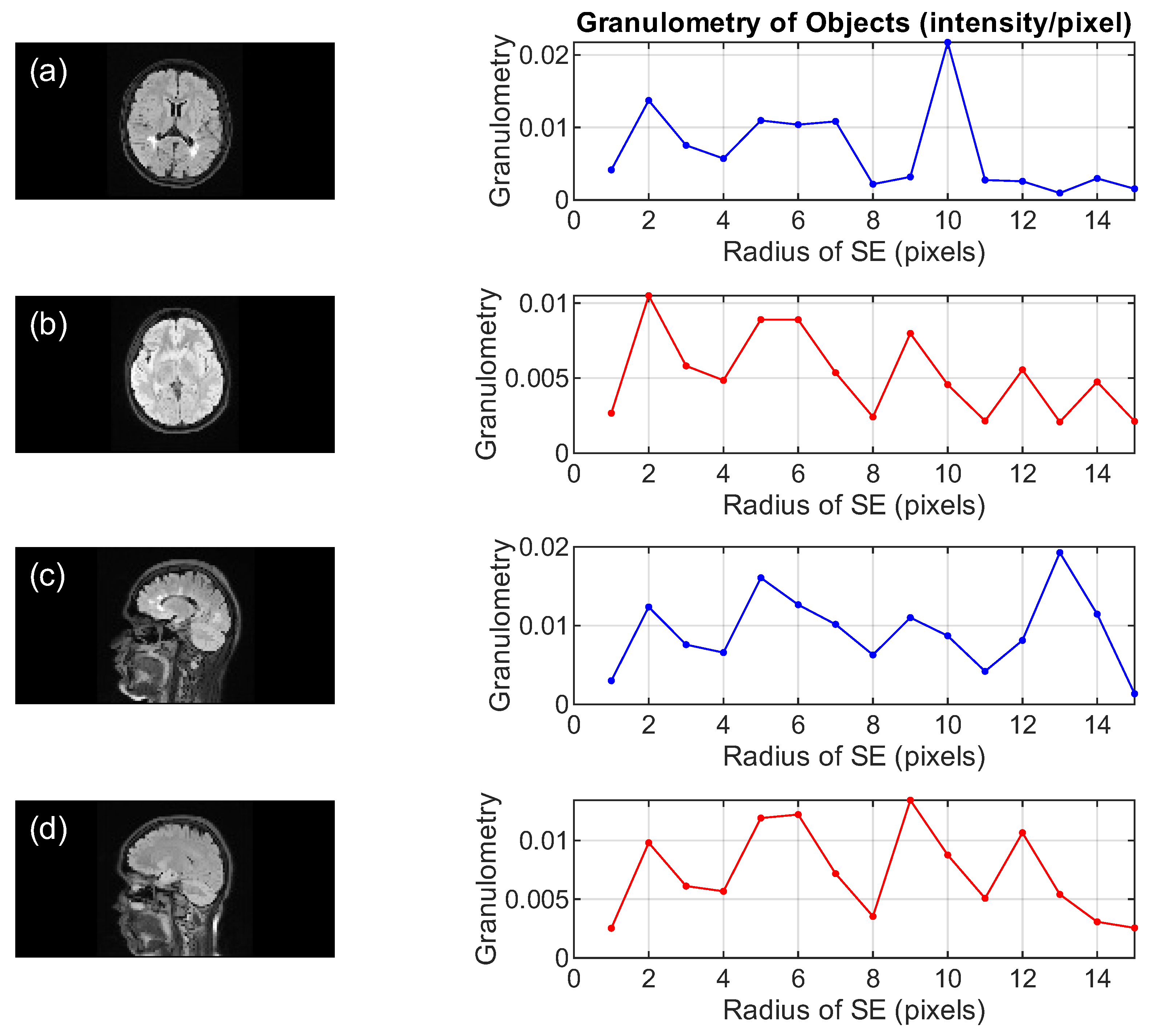 Training Artificial Neural Networks to Detect Multiple Sclerosis Lesions Using Granulometric ...