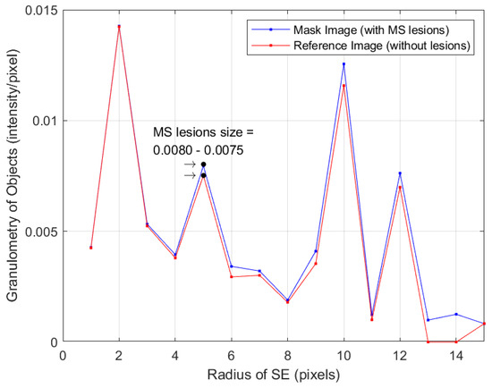 Training Artificial Neural Networks to Detect Multiple Sclerosis Lesions Using Granulometric ...