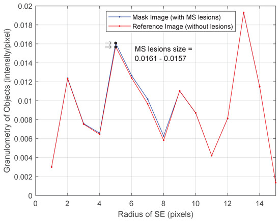 Technologies | Free Full-Text | Training Artificial Neural Networks to Detect Multiple Sclerosis ...