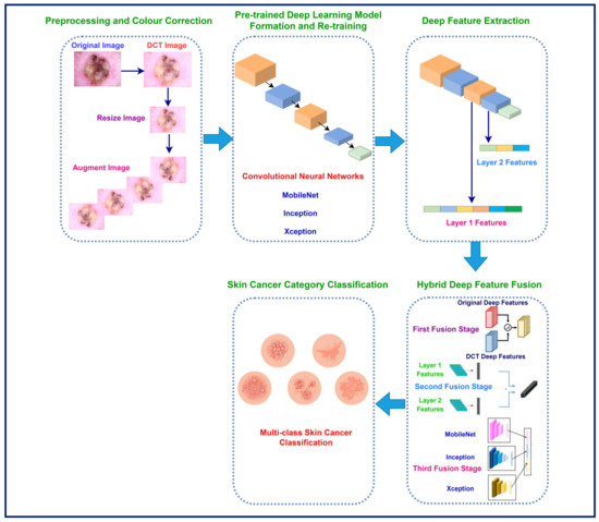 A Hybrid Trio-Deep Feature Fusion Model for Improved Skin Cancer ...