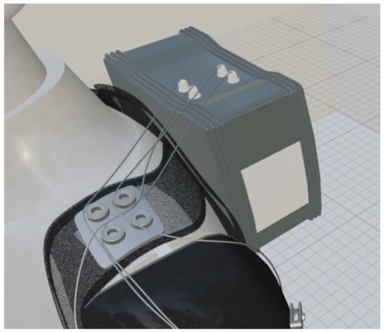 Mechanical Design, Analysis, and Dynamics Simulation of a Cable-Driven ...