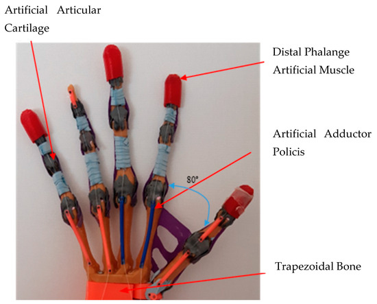 Prosthetic Hand Based on Human Hand Anatomy Controlled by Surface Electromyography and ...
