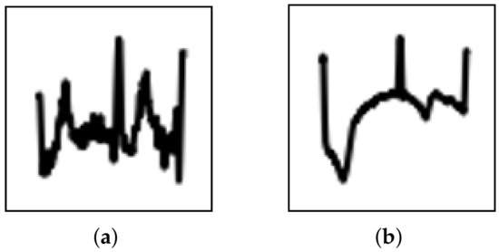 Preprocessing-Free Convolutional Neural Network Model for Arrhythmia ...