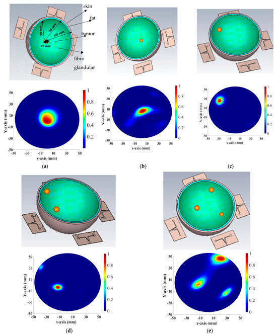 Simple Compact UWB Vivaldi Antenna Arrays for Breast Cancer Detection
