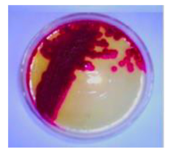 Extraction and Application of Pigment from Serratia marcescens SB08, an ...