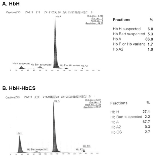 Alpha-Thalassemia: Diversity of Clinical Phenotypes and Update on the ...