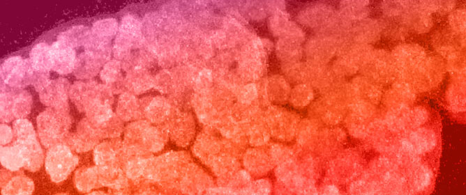 Non-Coding RNA | An Open Access Journal from MDPI