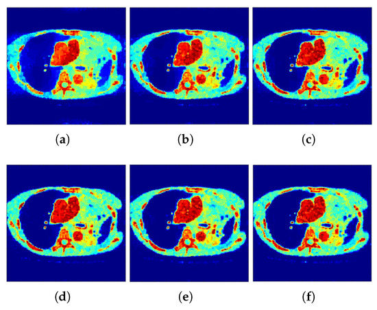 A Novel Iterative MLEM Image Reconstruction Algorithm Based on Beltrami ...