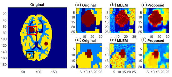 A Novel Iterative MLEM Image Reconstruction Algorithm Based on Beltrami ...