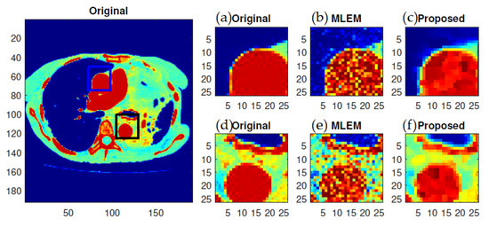 A Novel Iterative MLEM Image Reconstruction Algorithm Based on Beltrami ...