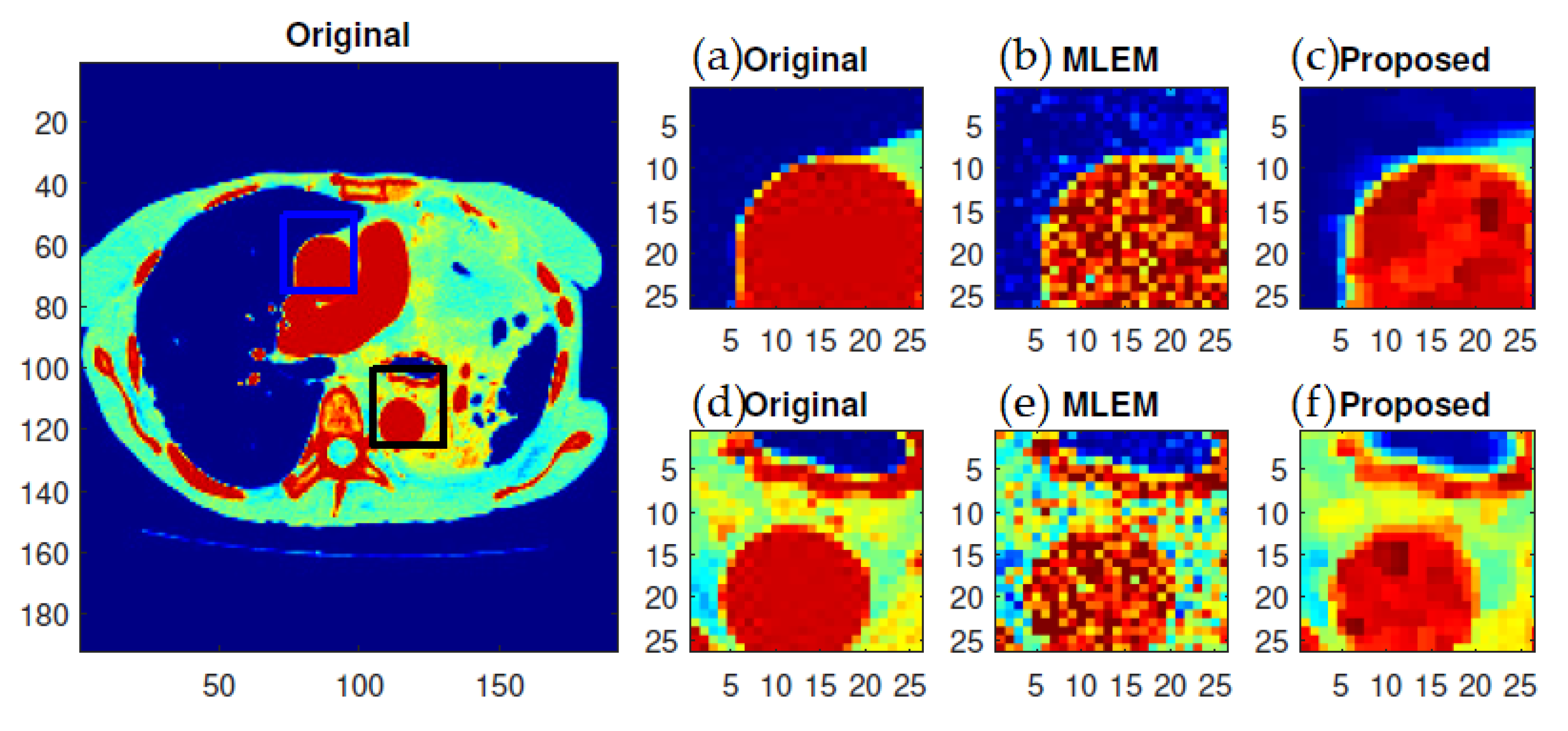 A Novel Iterative MLEM Image Reconstruction Algorithm Based on Beltrami Filter: Application to ...
