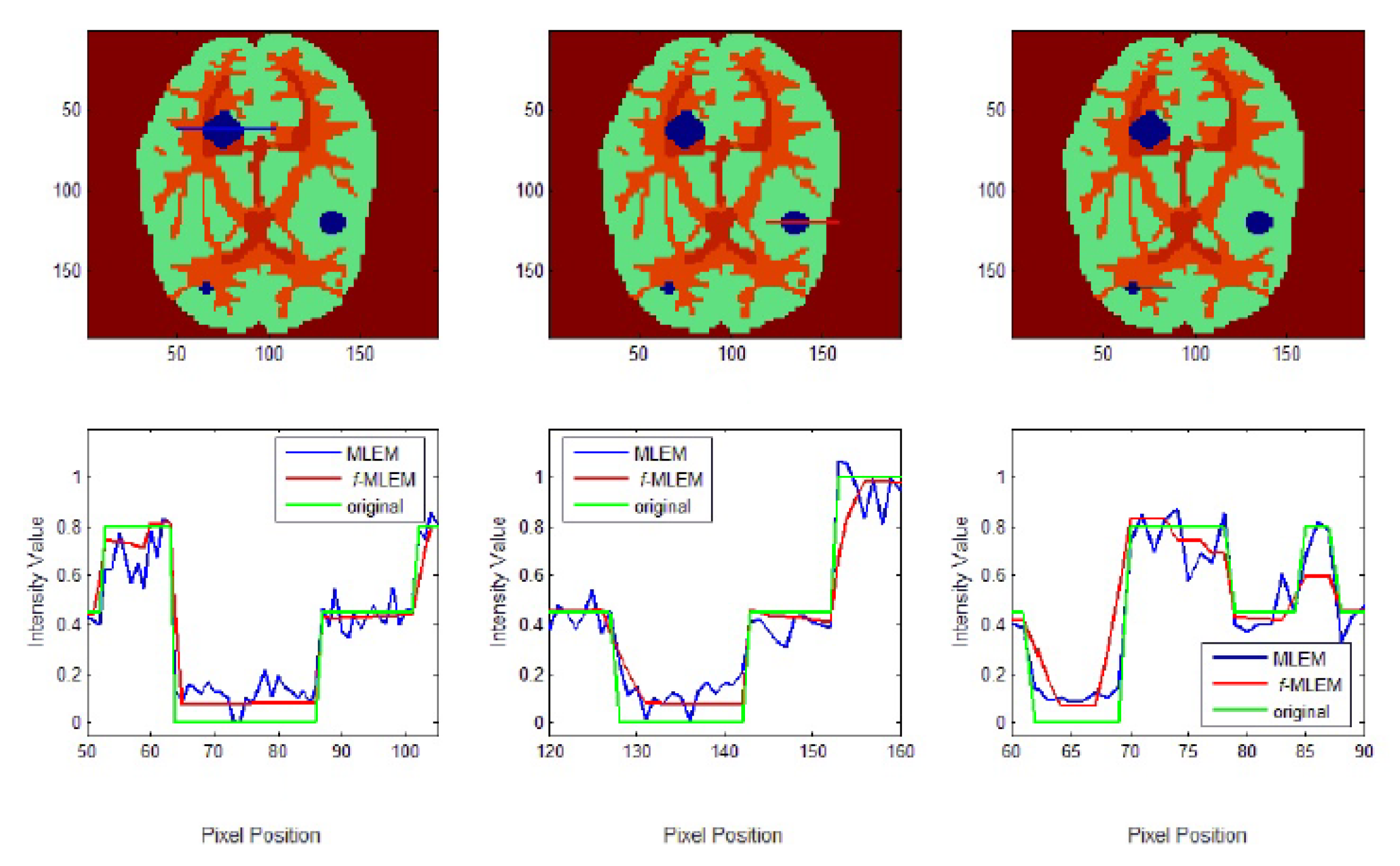 A Novel Iterative MLEM Image Reconstruction Algorithm Based on Beltrami ...