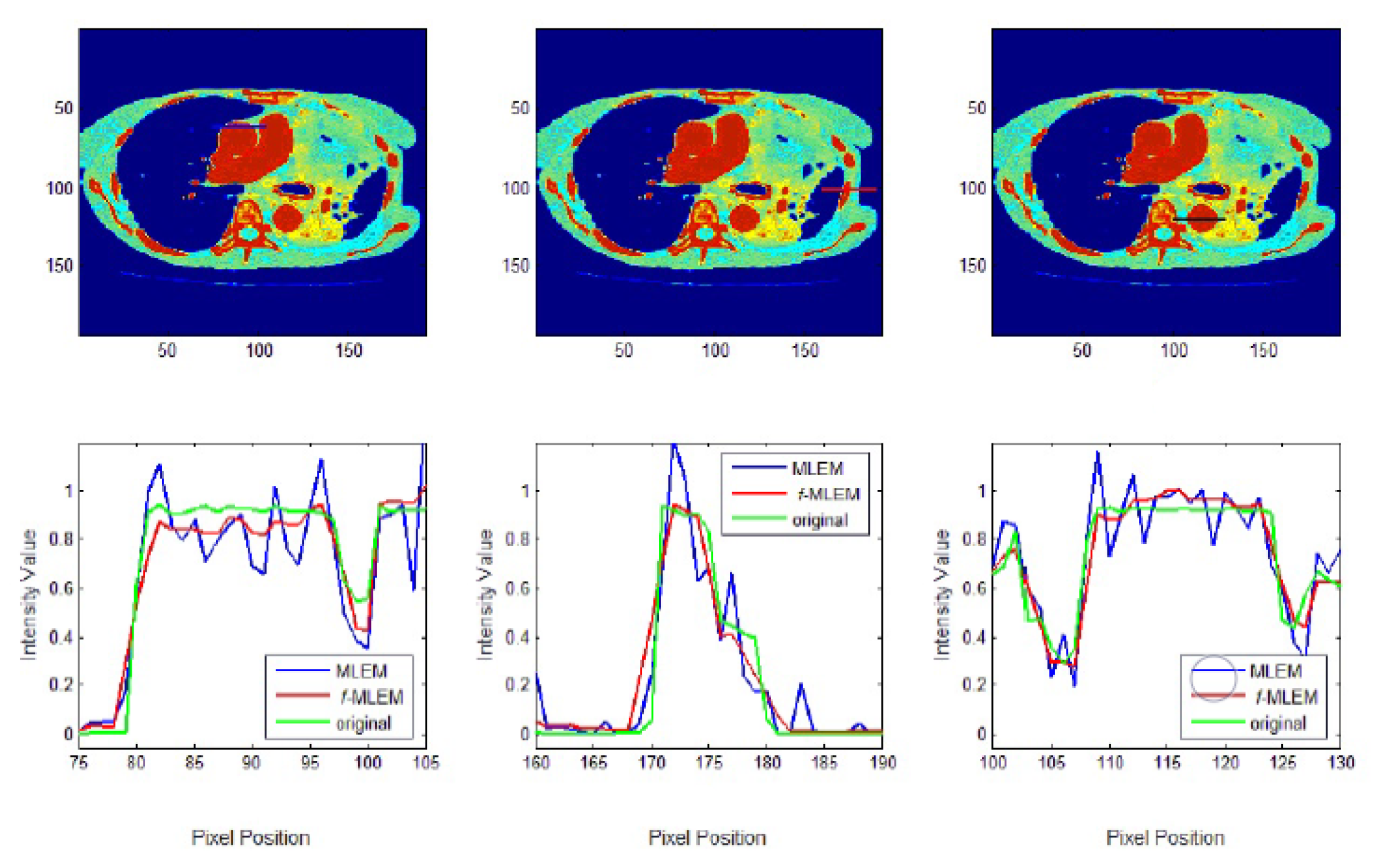 A Novel Iterative MLEM Image Reconstruction Algorithm Based on Beltrami Filter: Application to ...