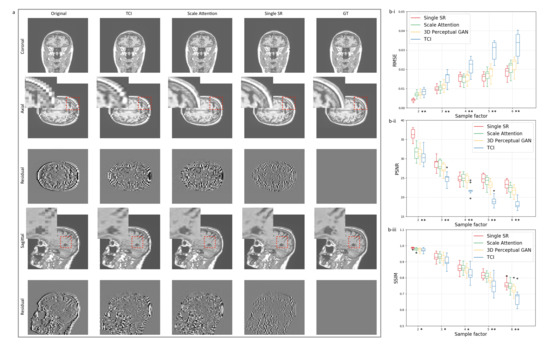 SOUP-GAN: Super-Resolution MRI Using Generative Adversarial Networks