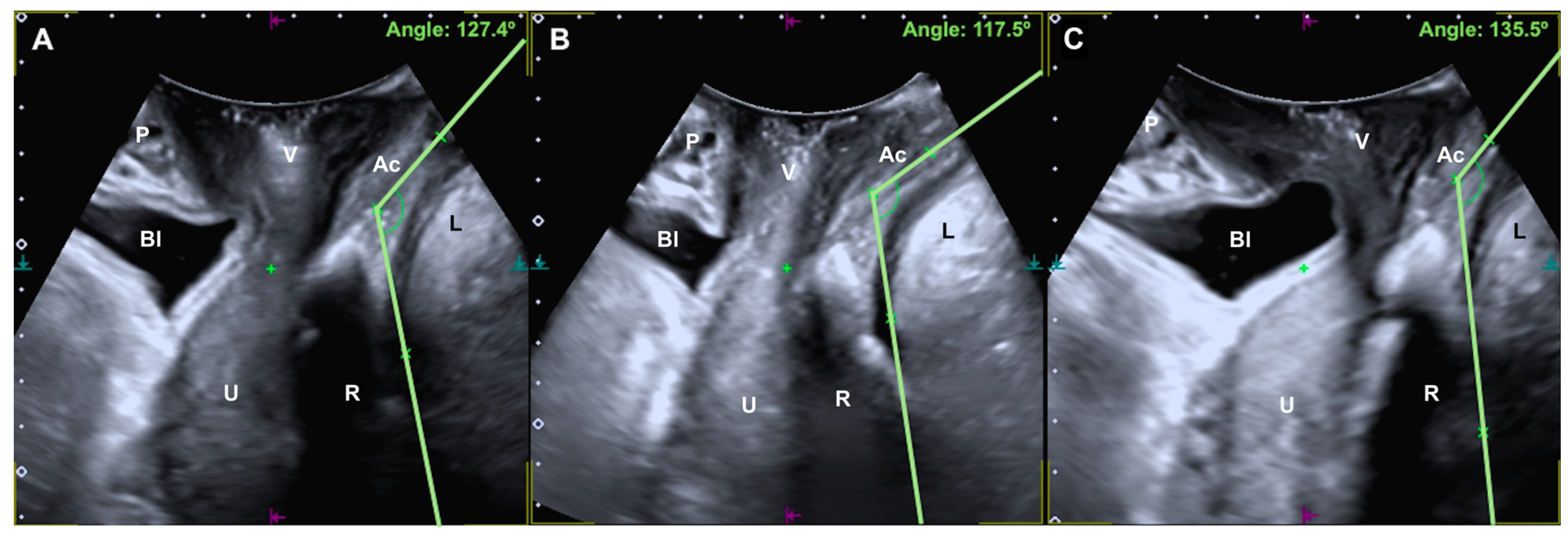 Tomography Free Full Text The Role Of Transperineal Ultrasound For