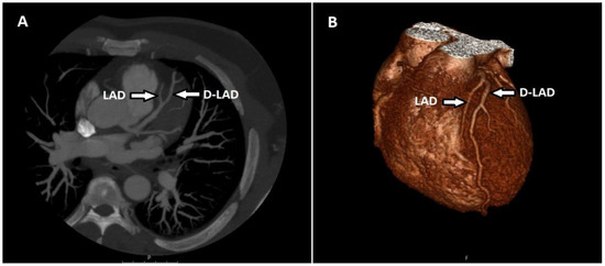 Tomography | An Open Access Journal from MDPI