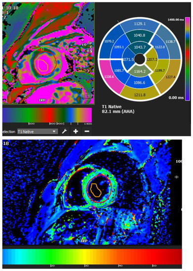 Tomography | An Open Access Journal from MDPI
