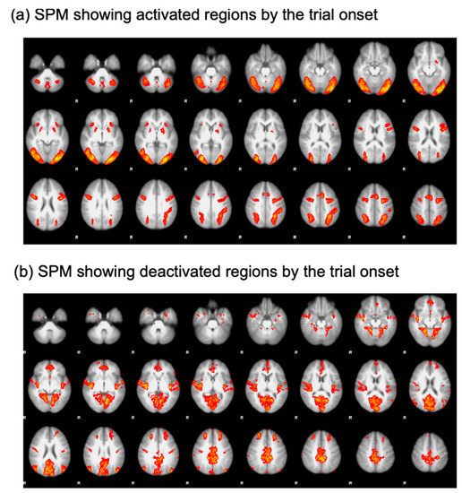 Neurocognitive Mechanisms Underlying Internet/Smartphone Addiction: A ...
