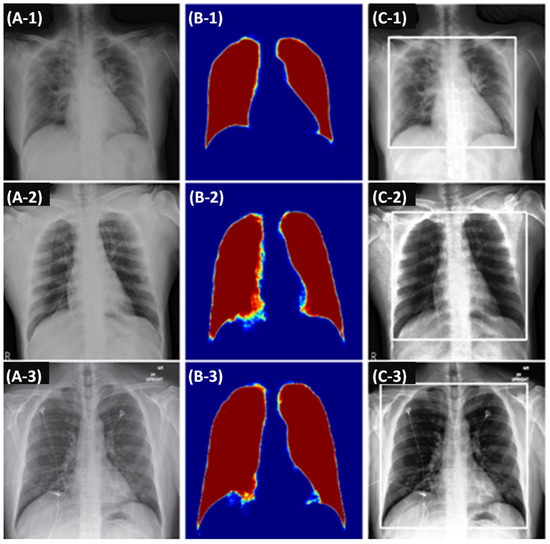 Tomography | An Open Access Journal from MDPI