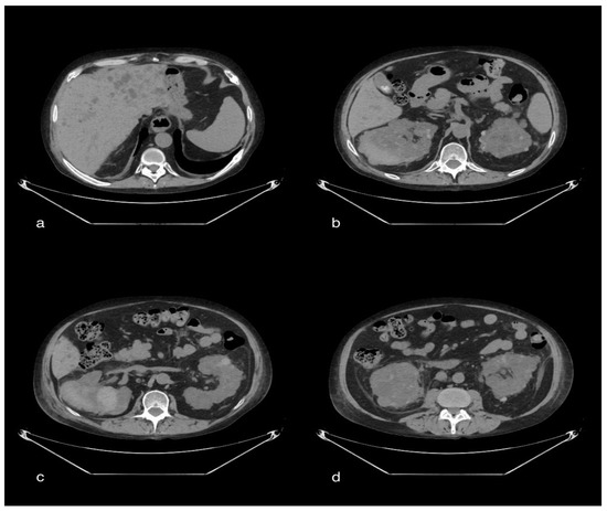 Tomography | An Open Access Journal from MDPI