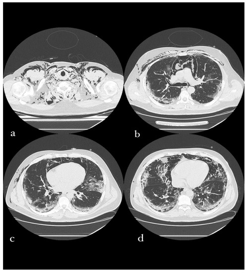 Tomography | An Open Access Journal from MDPI