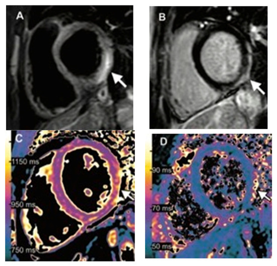 Tomography | An Open Access Journal from MDPI