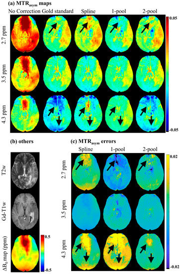 Tomography | An Open Access Journal from MDPI