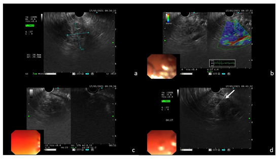 Tomography | An Open Access Journal from MDPI
