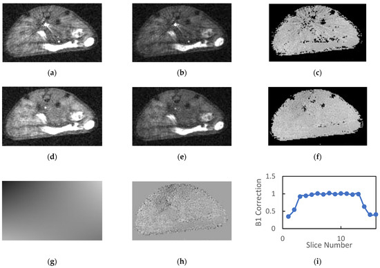 Tomography | Free Full-Text | Dynamic Contrast-Enhanced MRI in the ...