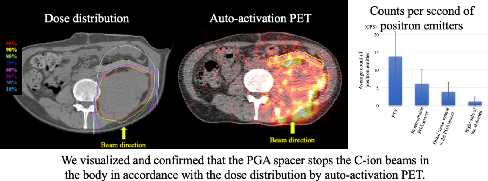 Tomography | Free Full-Text | Visualizing Bioabsorbable Spacer ...