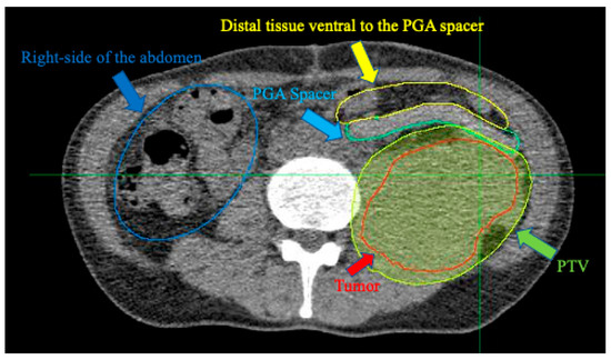 Tomography | An Open Access Journal from MDPI
