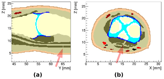 Tomography | An Open Access Journal from MDPI