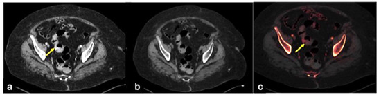Tomography | An Open Access Journal from MDPI