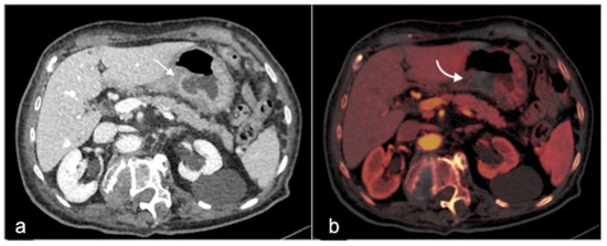 Tomography | An Open Access Journal from MDPI