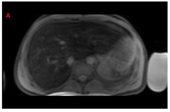 Tomography | An Open Access Journal from MDPI