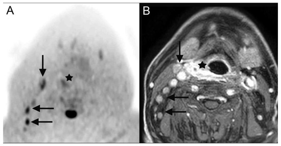 Tomography | An Open Access Journal from MDPI
