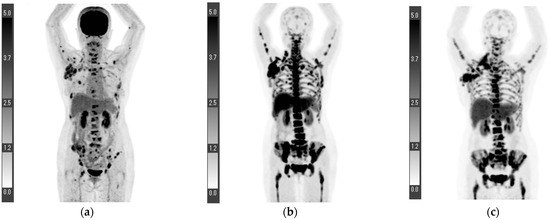 Tomography | An Open Access Journal from MDPI