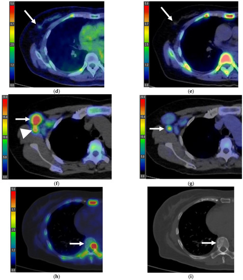 Tomography | An Open Access Journal from MDPI