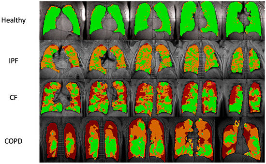Tomography | An Open Access Journal from MDPI