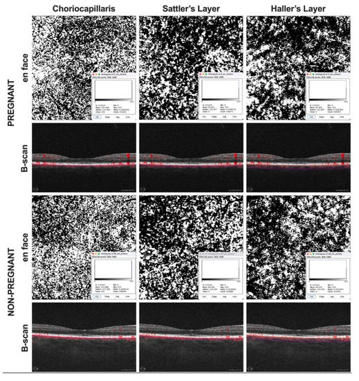 Tomography | An Open Access Journal from MDPI