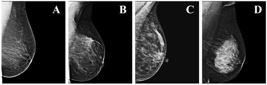 A Review of Computer-Aided Breast Cancer Diagnosis Using Sequential Mammograms