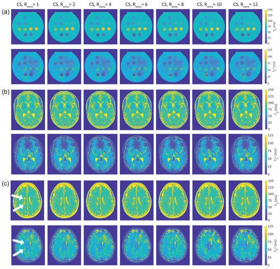 Accelerated Simultaneous T2 and T2* Mapping of Multiple Sclerosis ...