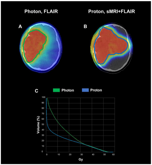 Spectroscopic MRI-Guided Proton Therapy in Non-Enhancing Pediatric High ...