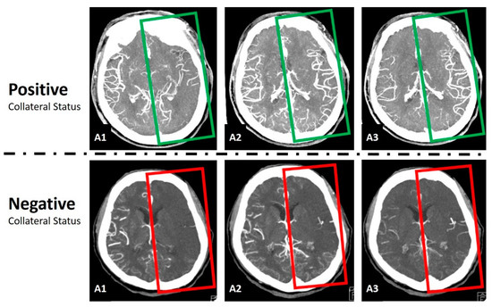 Using Deep-Learning-Based Artificial Intelligence Technique to Automatically Evaluate the ...