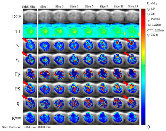 Textural Features of Mouse Glioma Models Measured by Dynamic Contrast ...