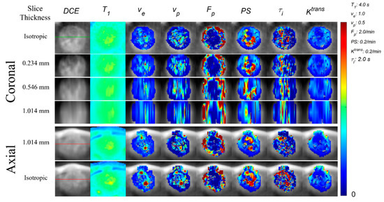 Textural Features of Mouse Glioma Models Measured by Dynamic Contrast-Enhanced MR Images with 3D ...