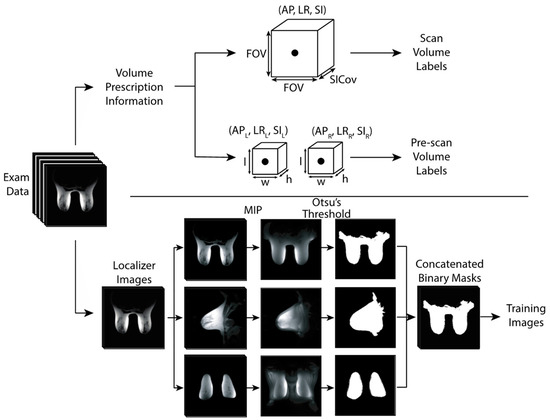 Automated Placement of Scan and Pre-Scan Volumes for Breast MRI Using a ...